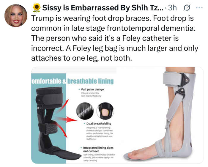 Catheter? Leg Braces? Internet Reacts to Apparent Bulges in Trump’s ...