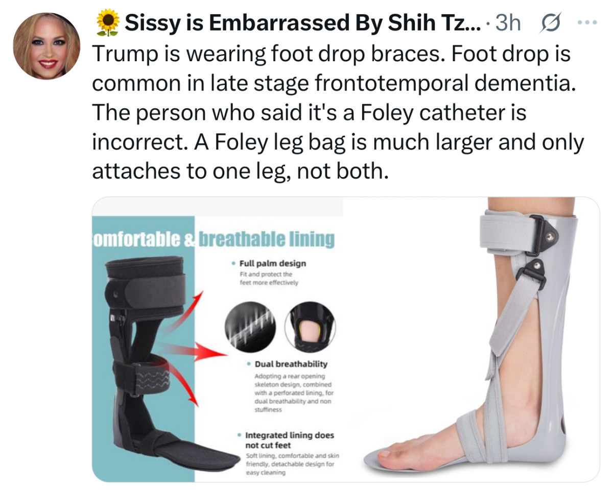 Catheter? Leg Braces? Internet Reacts to Apparent Bulges in Trump’s ...